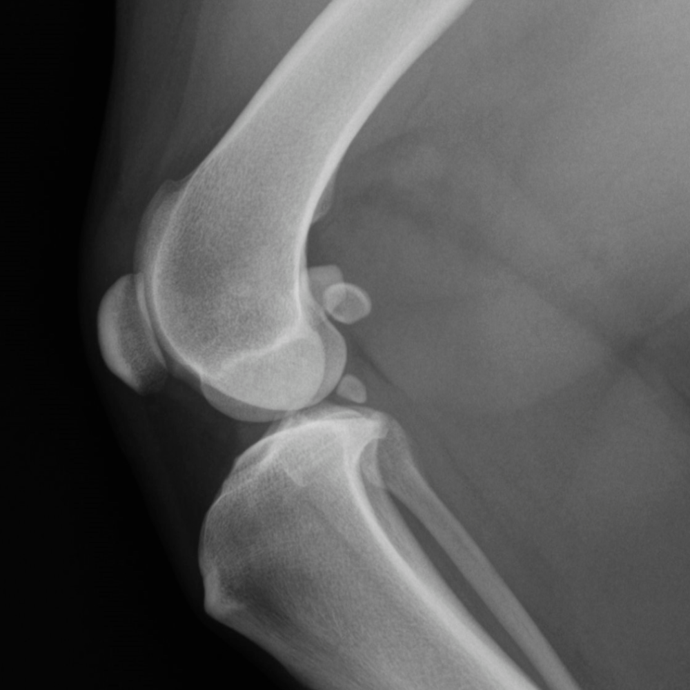 CCL Rupture – Basics of Surgical Therapy (EN) - Upskill.vet
